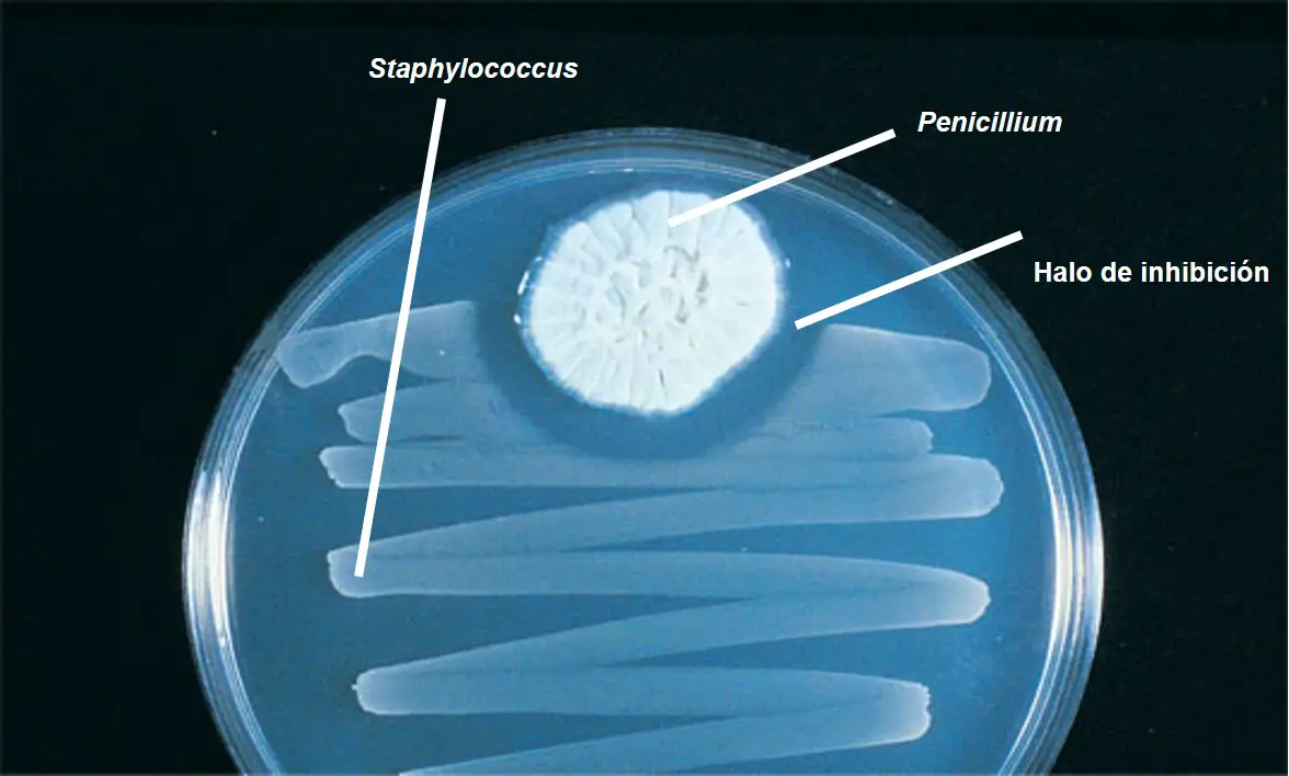 Penicilina: "la droga milagrosa", conoce su origen, propiedades y más