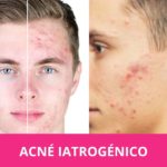 Resorcinol: Qué es, para qué sirve, estructuras y más