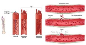 Dienogest: Nombre comercial, efectos secundarios, beneficios y más