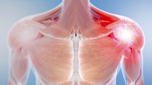 Etofenamato: ¿Qué es?, ¿Para qué sirve?, Nombre comercial y más