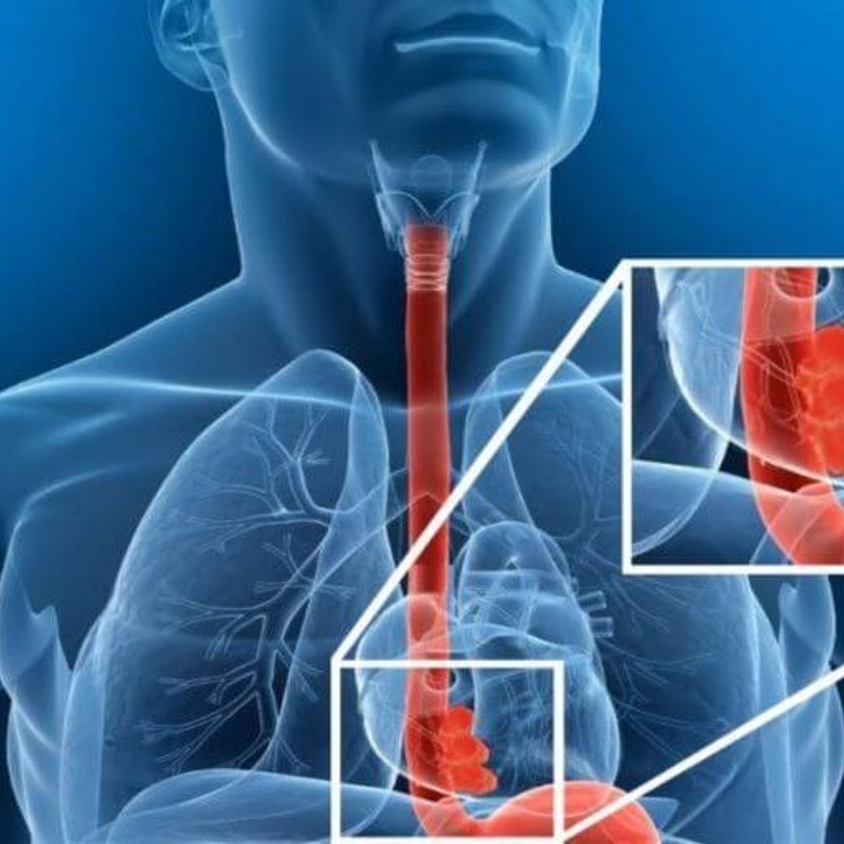 Enfermedades del aparato digestivo